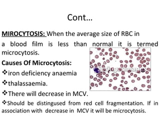 morphology of red blood cells | PPT