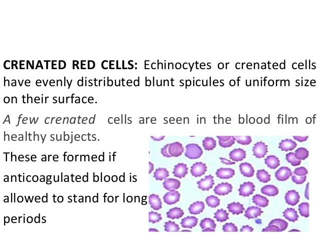 Red Blood Cell Morphology Echinocytes
