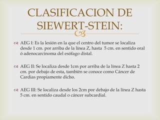 Tratamiento de Cáncer de Esófago | PPTX
