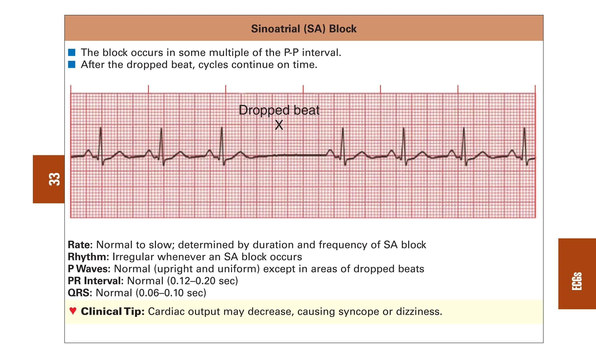 0803613474 - ECG Notes Interpretation And Management Guide.pdf
