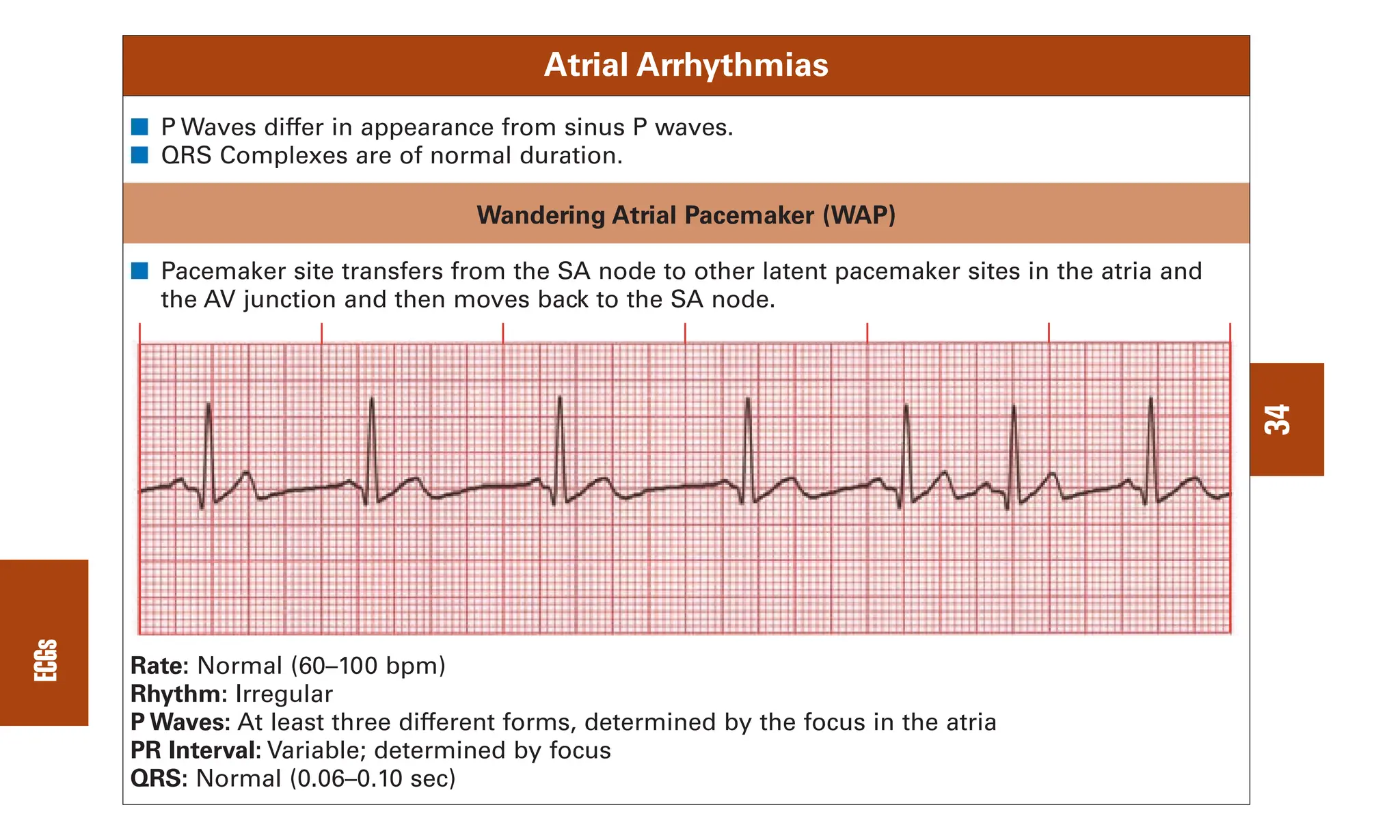 0803613474 - ECG Notes Interpretation And Management Guide.pdf