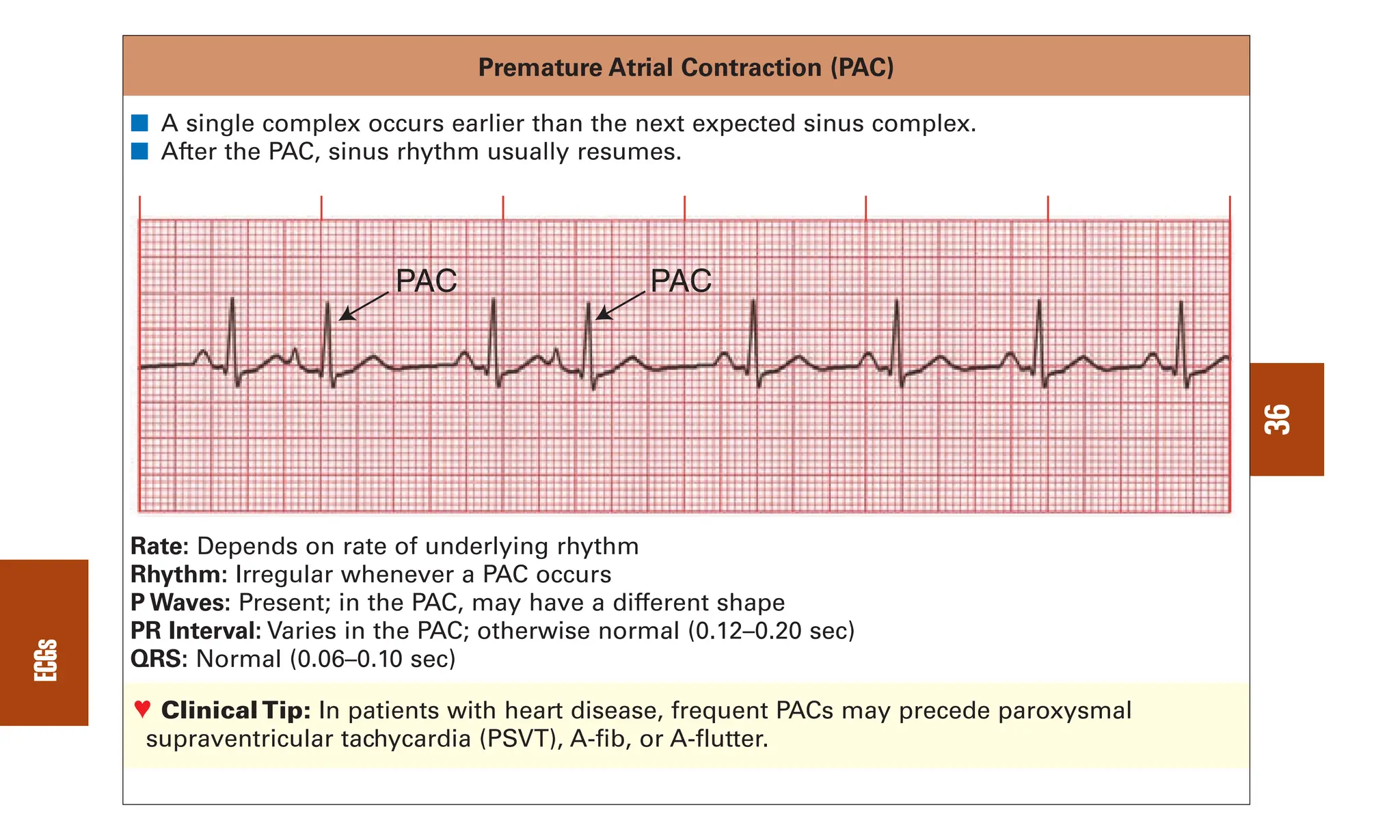 0803613474 - ECG Notes Interpretation And Management Guide.pdf