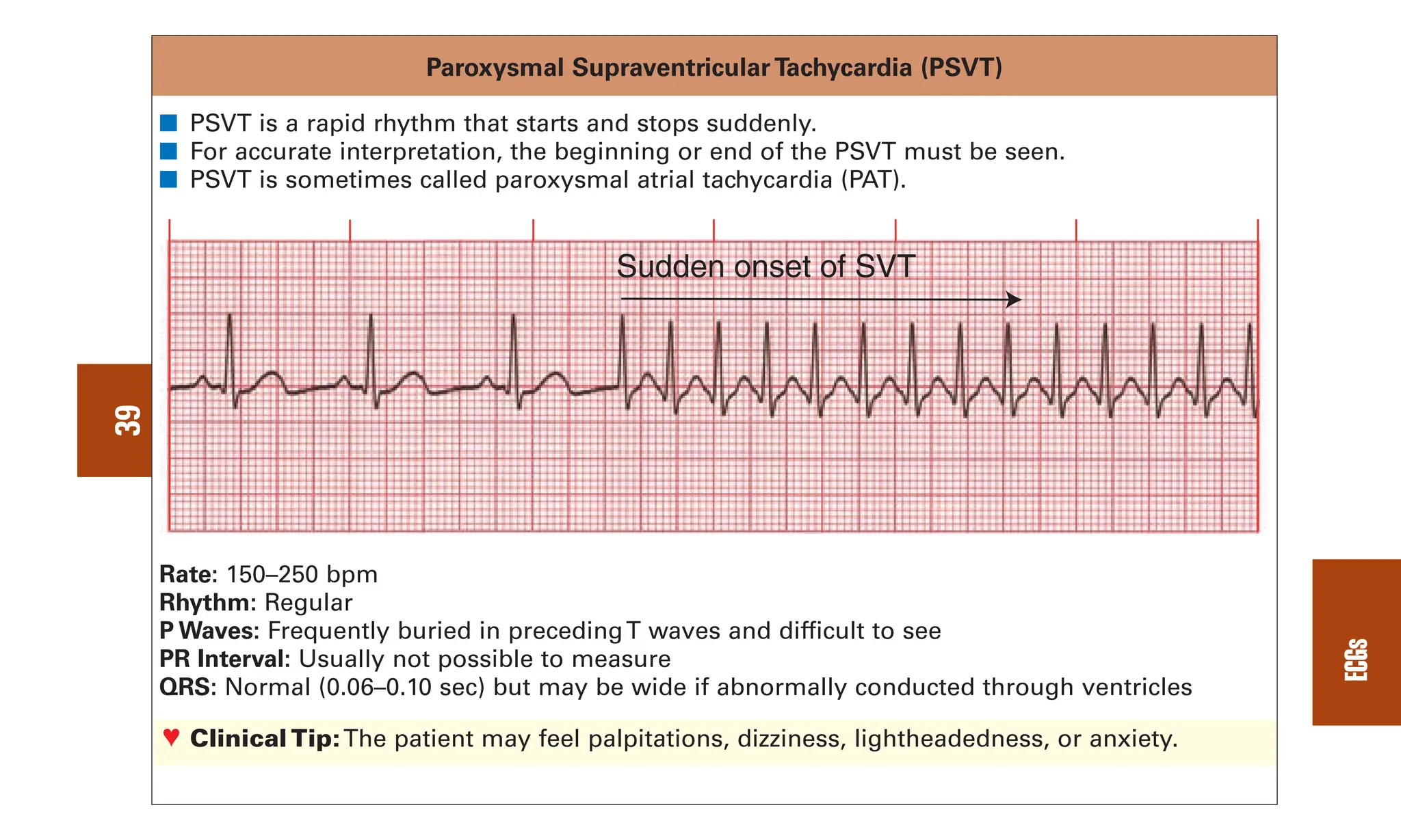 0803613474 - ECG Notes Interpretation And Management Guide.pdf