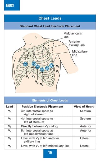 0803613474 - ECG Notes Interpretation And Management Guide.pdf