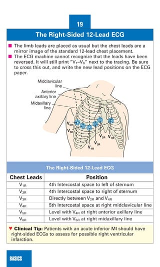 0803613474 - ECG Notes Interpretation And Management Guide.pdf