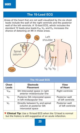 0803613474 - ECG Notes Interpretation And Management Guide.pdf