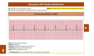 0803613474 - ECG Notes Interpretation And Management Guide.pdf