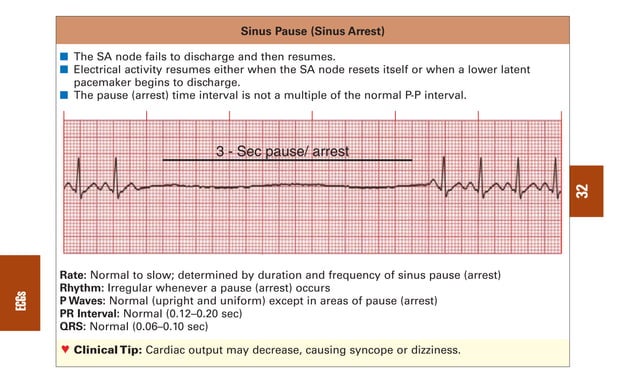 0803613474 - ECG Notes Interpretation And Management Guide.pdf