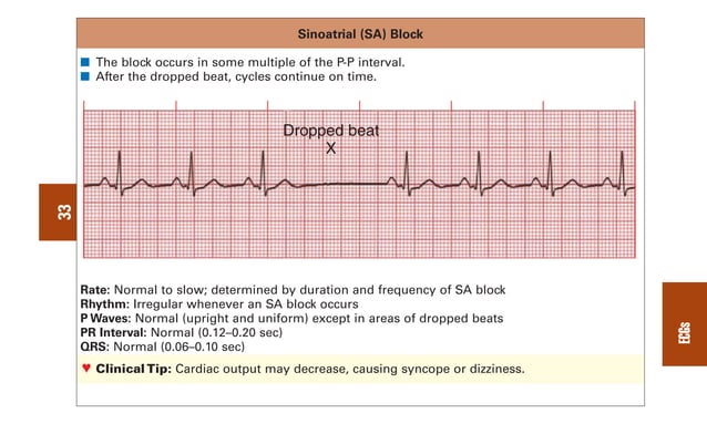 0803613474 - ECG Notes Interpretation And Management Guide.pdf