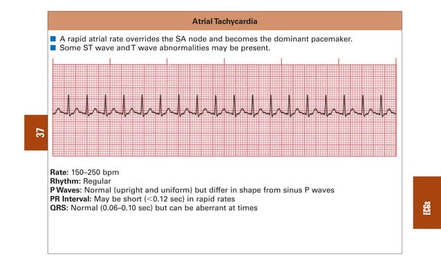 0803613474 - ECG Notes Interpretation And Management Guide.pdf