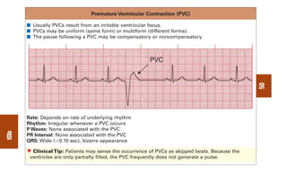 0803613474 - ECG Notes Interpretation And Management Guide.pdf
