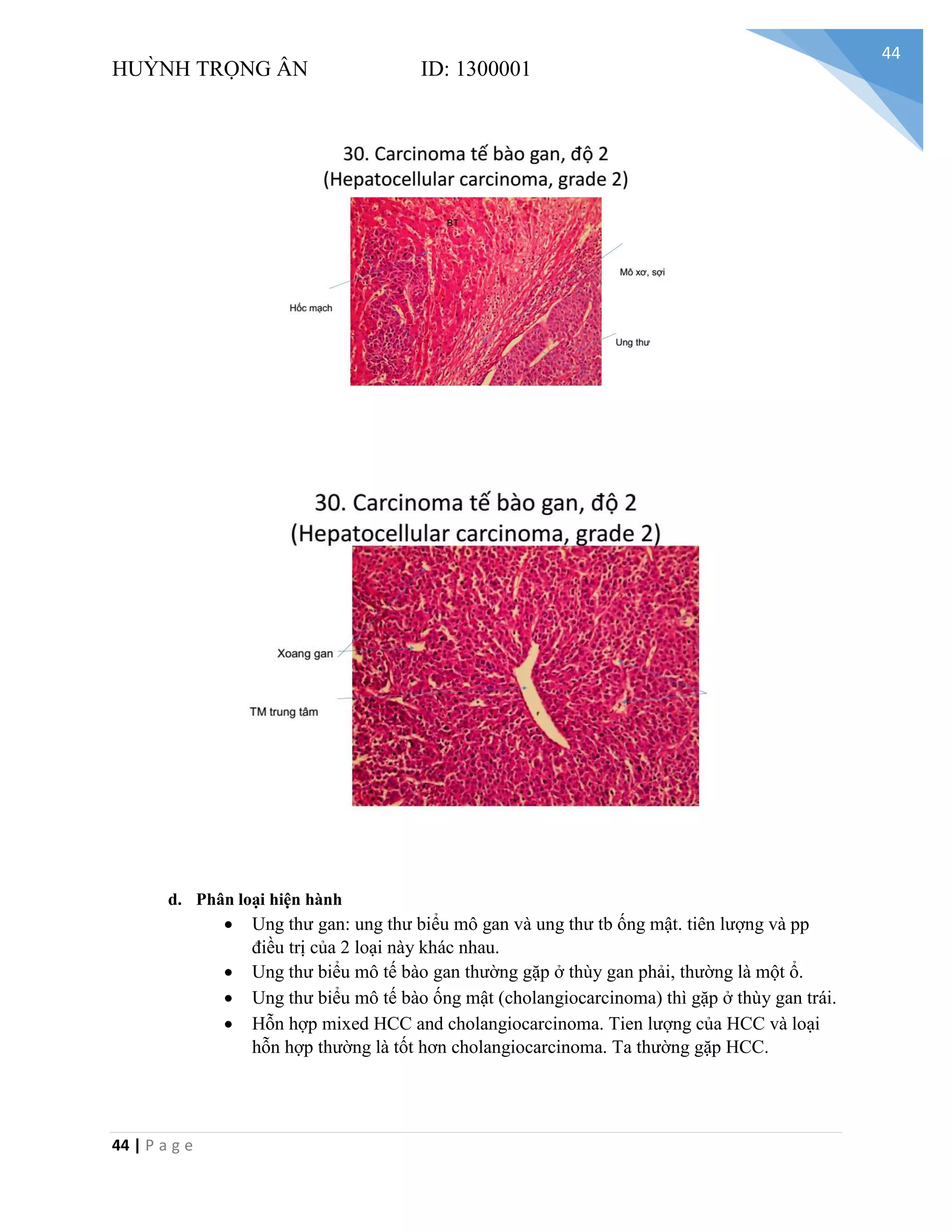 Thực hành giải phẫu bệnh cho sinh viên y 3 | PDF