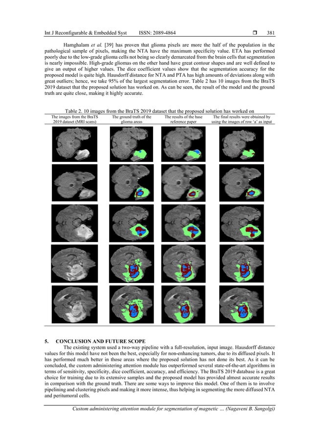 Custom administering attention module for segmentation of magnetic ...
