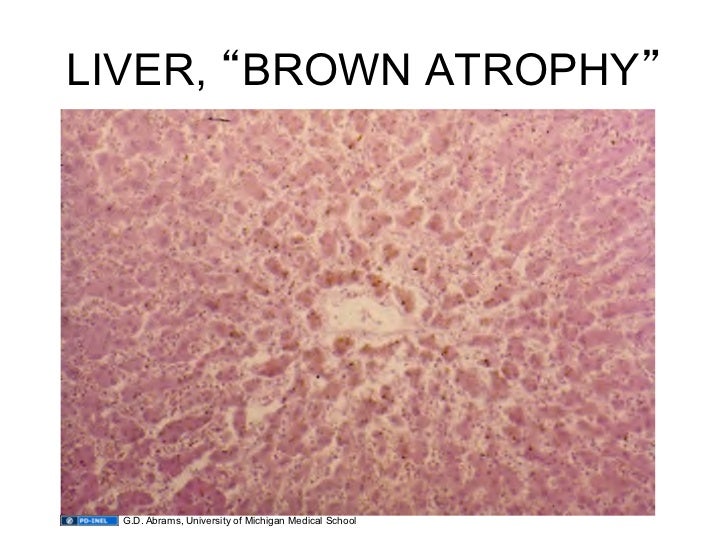 08.25.08: Neoplasia I