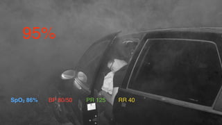 The future of prehospital trauma resuscitation: Brian Burns | PDF