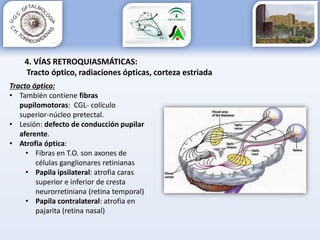 086 Anatomía clínica del nervio óptico y vias visuales - LOM.pdf