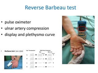 08 Bernat aimradial20170921 Radial patency | PPT