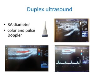 08 Bernat aimradial20170921 Radial patency | PPT
