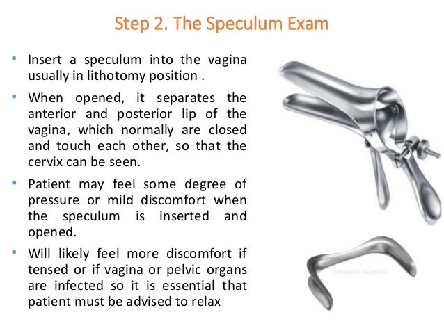 Carcinoma cervix pre management workup