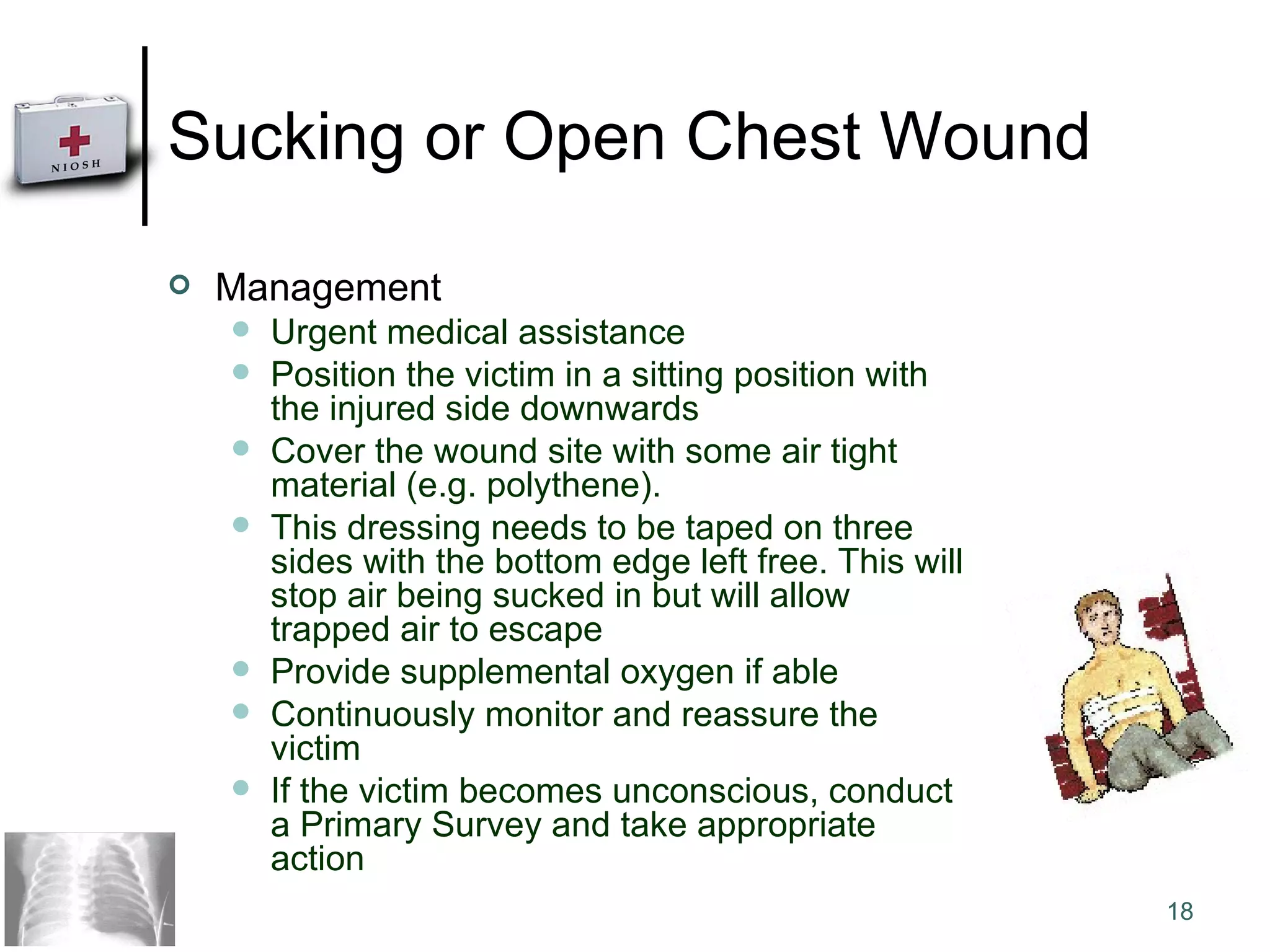 First Aid For Chest Injury | PPT