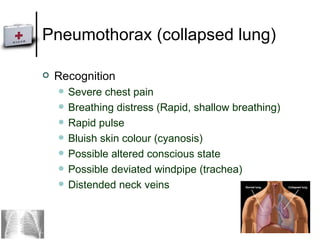 First Aid For Chest Injury | PPT