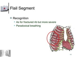 First Aid For Chest Injury | PPT