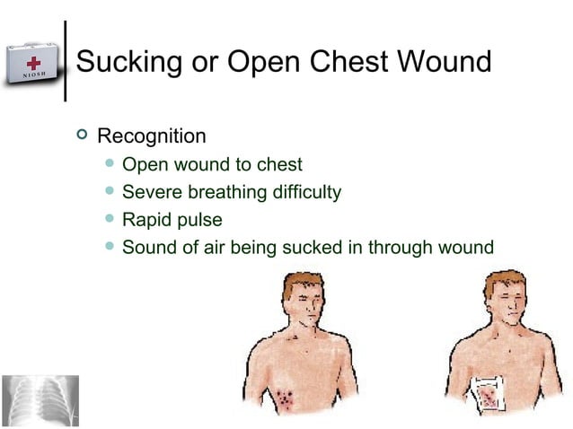 First Aid For Chest Injury | PPT