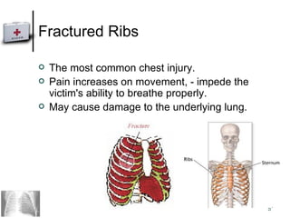First Aid For Chest Injury | PPT