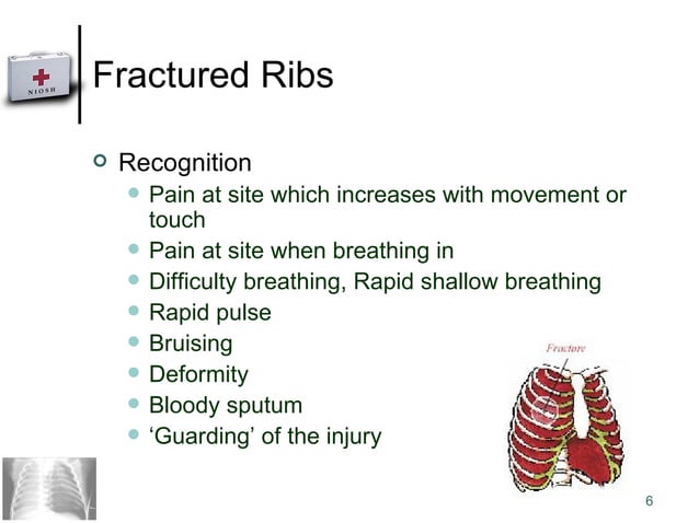 First Aid For Chest Injury | PPT