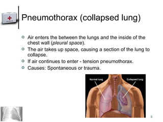 First Aid For Chest Injury | PPT