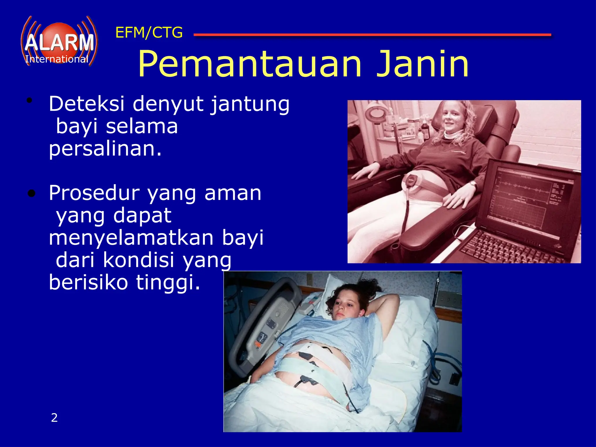Electronic Fetal Monitoring (EFM-CTG).pptx