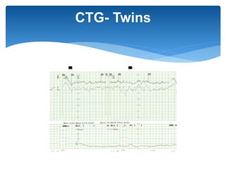 08 ctg isam ws | PPT