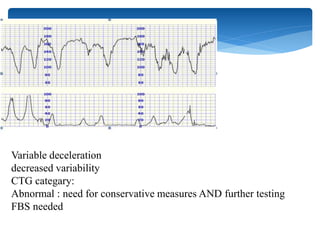 08 ctg isam ws | PPT