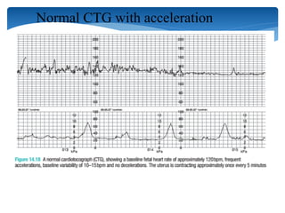 08 ctg isam ws | PPT