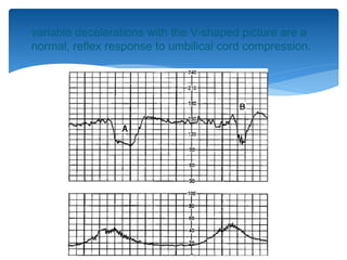 08 ctg isam ws | PPT