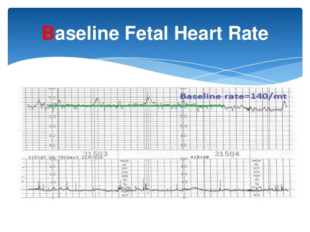 Fetal Heart Rate Chart By Week What Is The “normal” Fetal Heart