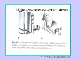Denture base considerations in removable partial denture /RPD | PPT