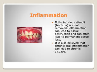 Overview of Oral Inflammation | PPTX | Dental Health | Diseases and ...