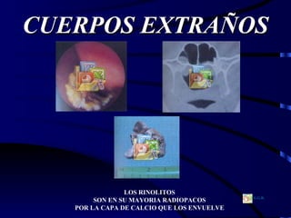 oto 08 Obstruccion Nasal | PPT