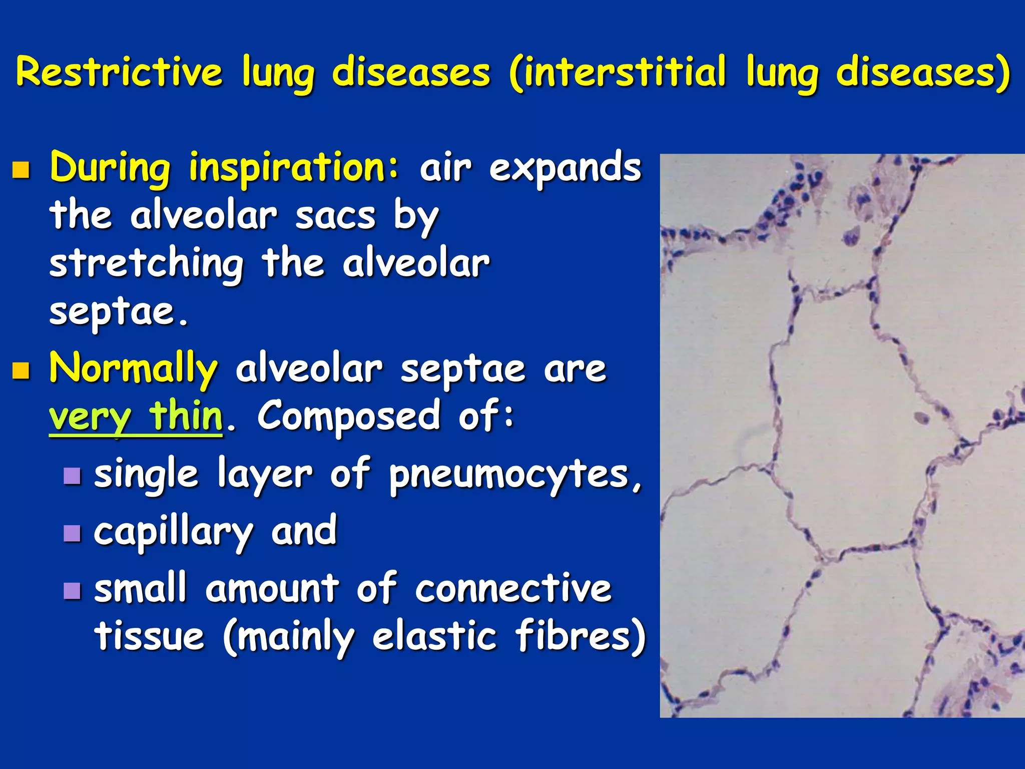 08 respiratory restrictive | PPT