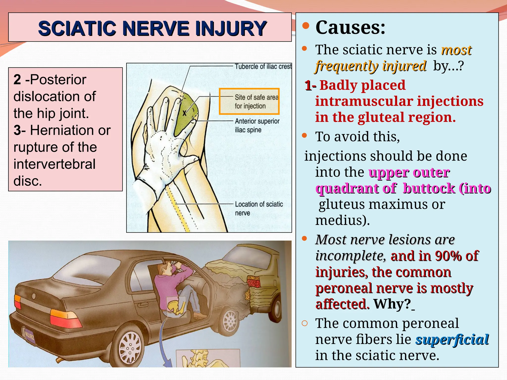 08Anatomy of the SCIATIC NERVE and it formation | PPT
