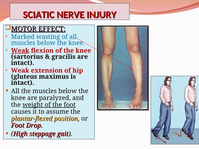 08Anatomy of the SCIATIC NERVE and it formation | PPT