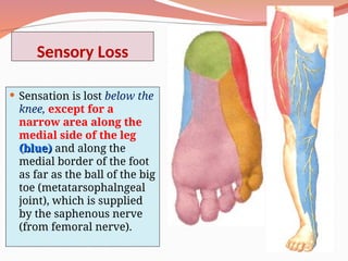 08Anatomy of the SCIATIC NERVE and it formation | PPT