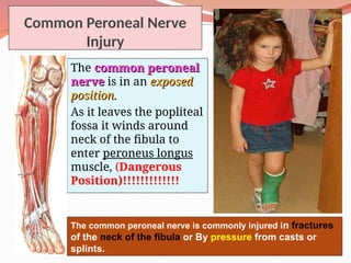 08Anatomy of the SCIATIC NERVE and it formation | PPT