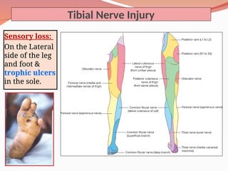 08Anatomy of the SCIATIC NERVE and it formation | PPT