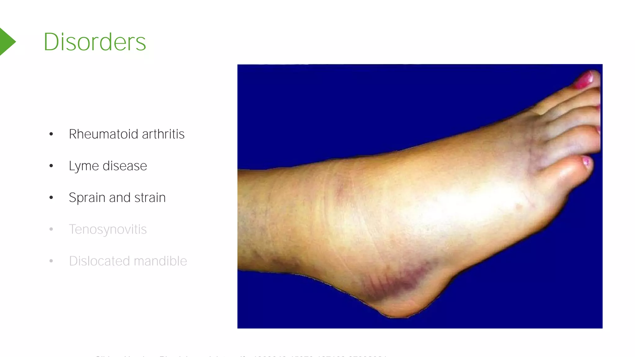 08 The Skeletal System - Joints (1).pdf