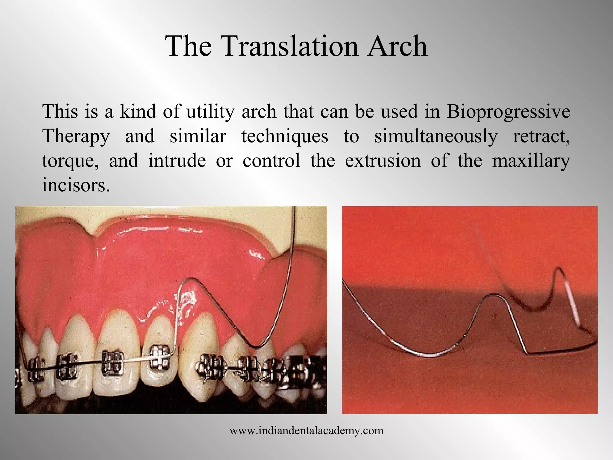 08 the translation arch | PPT