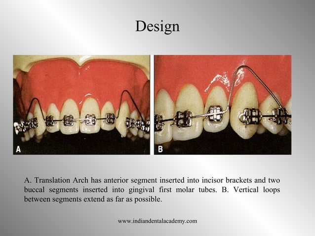 08 the translation arch | PPT