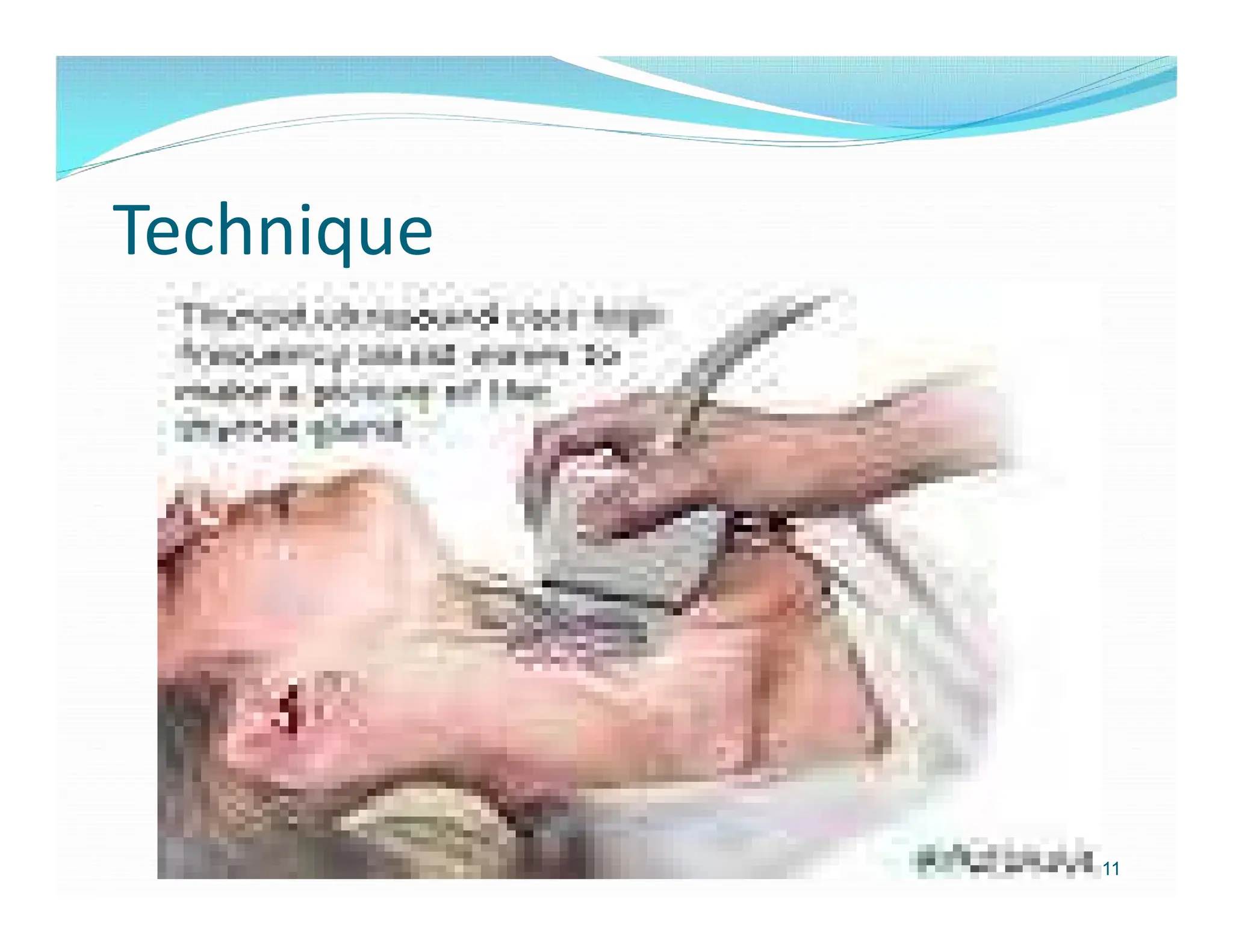 08Thyroid.pdf ultrasound of the thyroid. | PDF