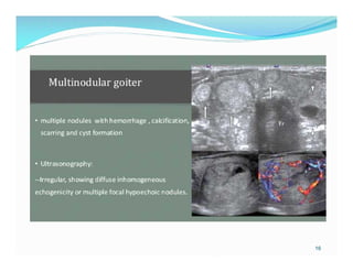 08Thyroid.pdf ultrasound of the thyroid. | PDF